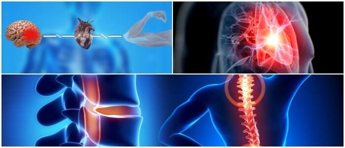 Shock O Choque Neurogénico Definición Causas Fisiopatología