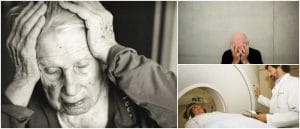 Cerebritis o Inflamación del Cerebro: Cognición, Trastornos, Causas ...