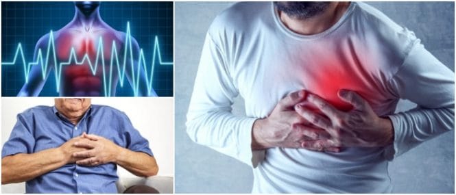 Dolor Torácico: Definición, Síntomas, Causas, Diagnóstico y Tratamiento