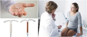 Dispositivo Intrauterino o DIU: ¿Qué es? Funcionamiento, Ventajas ...
