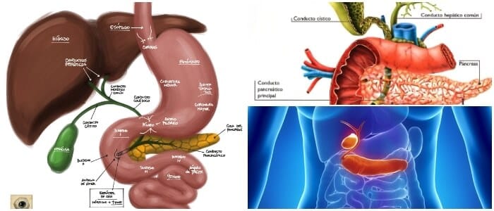 Coledocolitiasis: Causas, Síntomas, Diagnóstico, Factores De Riesgo y ...