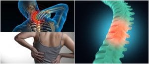 Mielopatia: Definición, Causas, Factores De Riesgo, Síntomas y Tratamiento