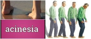 Acinesia: Definición, Causas, Síntomas, Relación Con La Enfermedad De ...