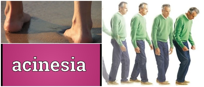Acinesia: Definición, Causas, Síntomas, Relación Con La Enfermedad De ...