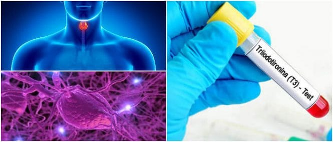 Triiodotironina: ¿Qué Es? ¿Cómo Se Controla? Trastornos Relacionados ...