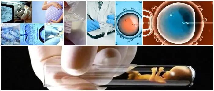 Fertilización Asistida ¿qué Es Procedimientos Riesgos Uso Ética Y