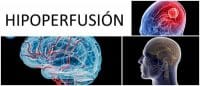 Hipoperfusión: ¿Qué Es? Síndrome Cerebral, Shock Circulatorio y ...