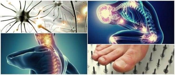 Dolor Neuropático: Causas, Síntomas, Tratamiento, Manejo y Panorama