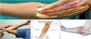 Nervio Cubital: ¿Qué es? Estructura, Función, Significación Clínica y ...