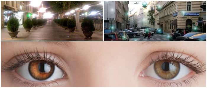 Fotopsias: Definición, Síntomas, Causas, Diagnóstico, Tratamiento y ...