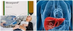 Meneparol: Presentación, Indicaciones, Mecanismo de Acción, Dosis ...