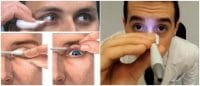 Reflejo Corneal: Definición, Neuroanatomía, Neurofisiología, Reflejos ...